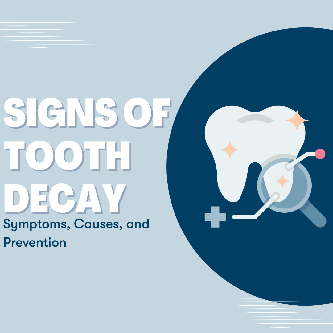 Signs of Tooth Decay: Symptoms, Causes, and Prevention - River Dental